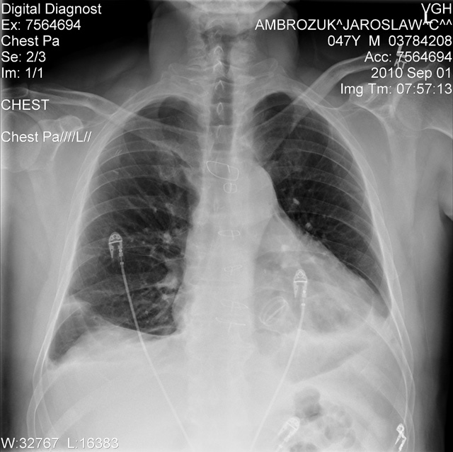 Procedure (Page 3) - BeatOnMyHeart